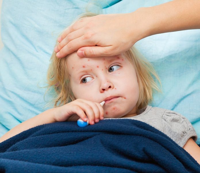 Enfermedades eruptivas en niños: ¿Cómo diferenciarlas y prevenirlas?