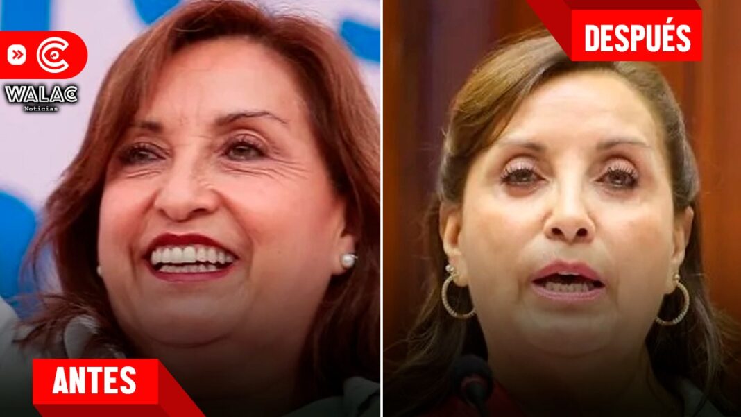 Dina Boluarte Se Sometió A Mejoras Estéticas Conoce Qué Se Operó